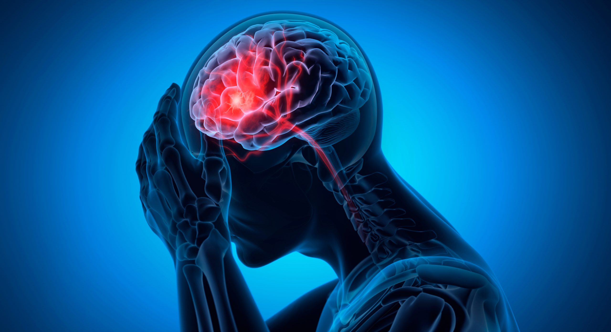 Thibodaux Regional Health System: Understand and Reduce Your Risk of Stroke